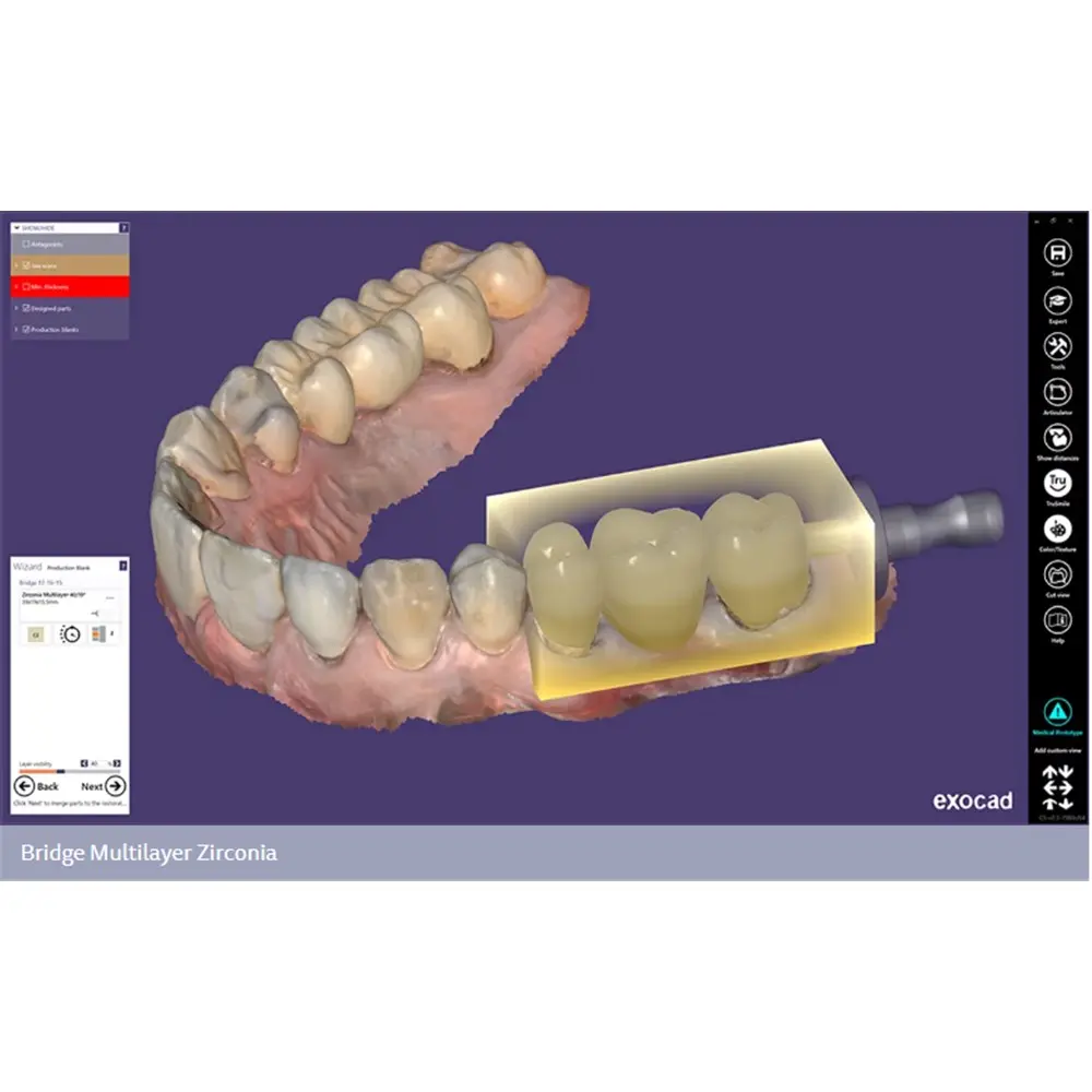 exocad DentalCAD In-CAD Nesting Module - Flex | Dental Digital Design